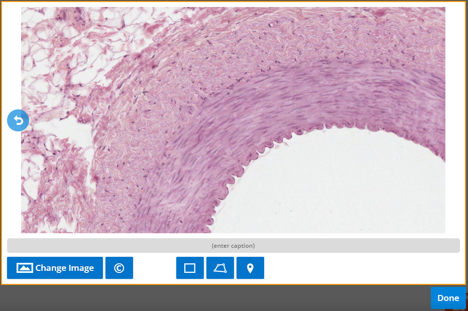 Creating Lt Hotspot Panels | ADInstruments